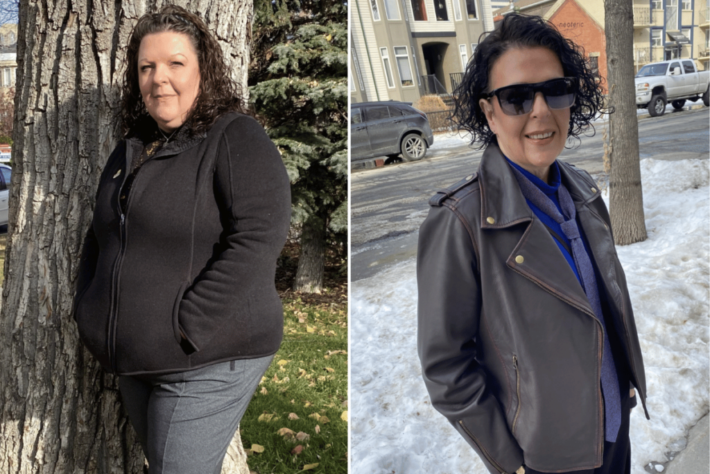 Reason #1: Ozempic Weight Loss Before and After Results Can Be Dramatic in the Belly Area