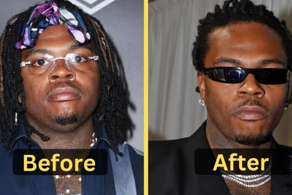 Uncovering the Top Benefits of Gunna’s Weight Loss Journey Before ...