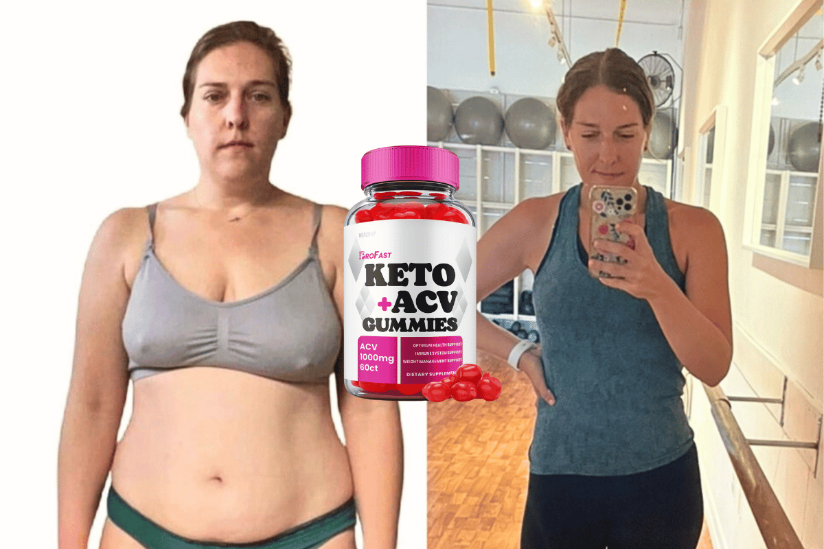 Keto ACV Gummies: A 2025 Guide to Boosting Your Weight Loss Journey | healthy